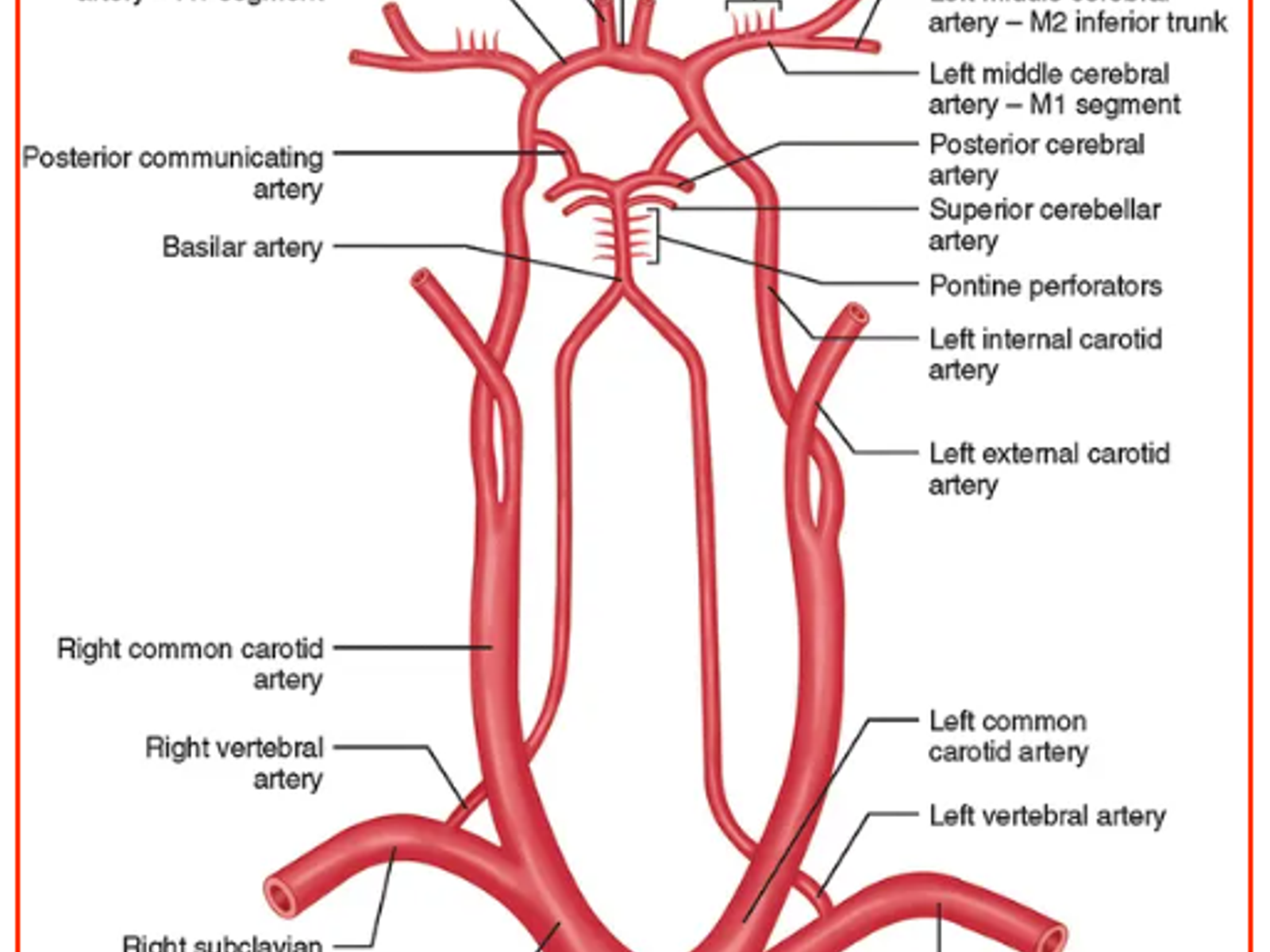 Cancer de la carotide : causes, symptômes, traitement, chirurgie, décès ...